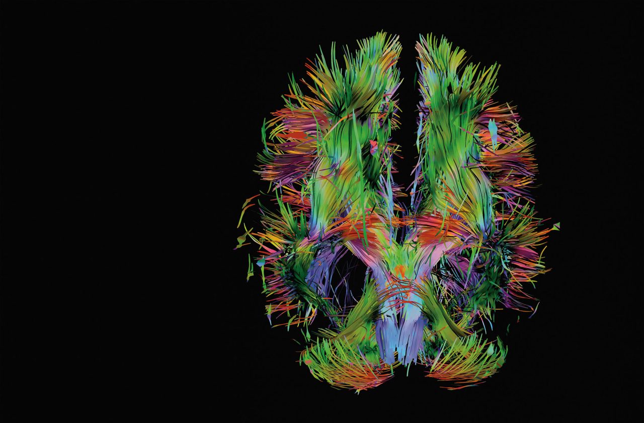 Brain Gains | Caltech Alumni